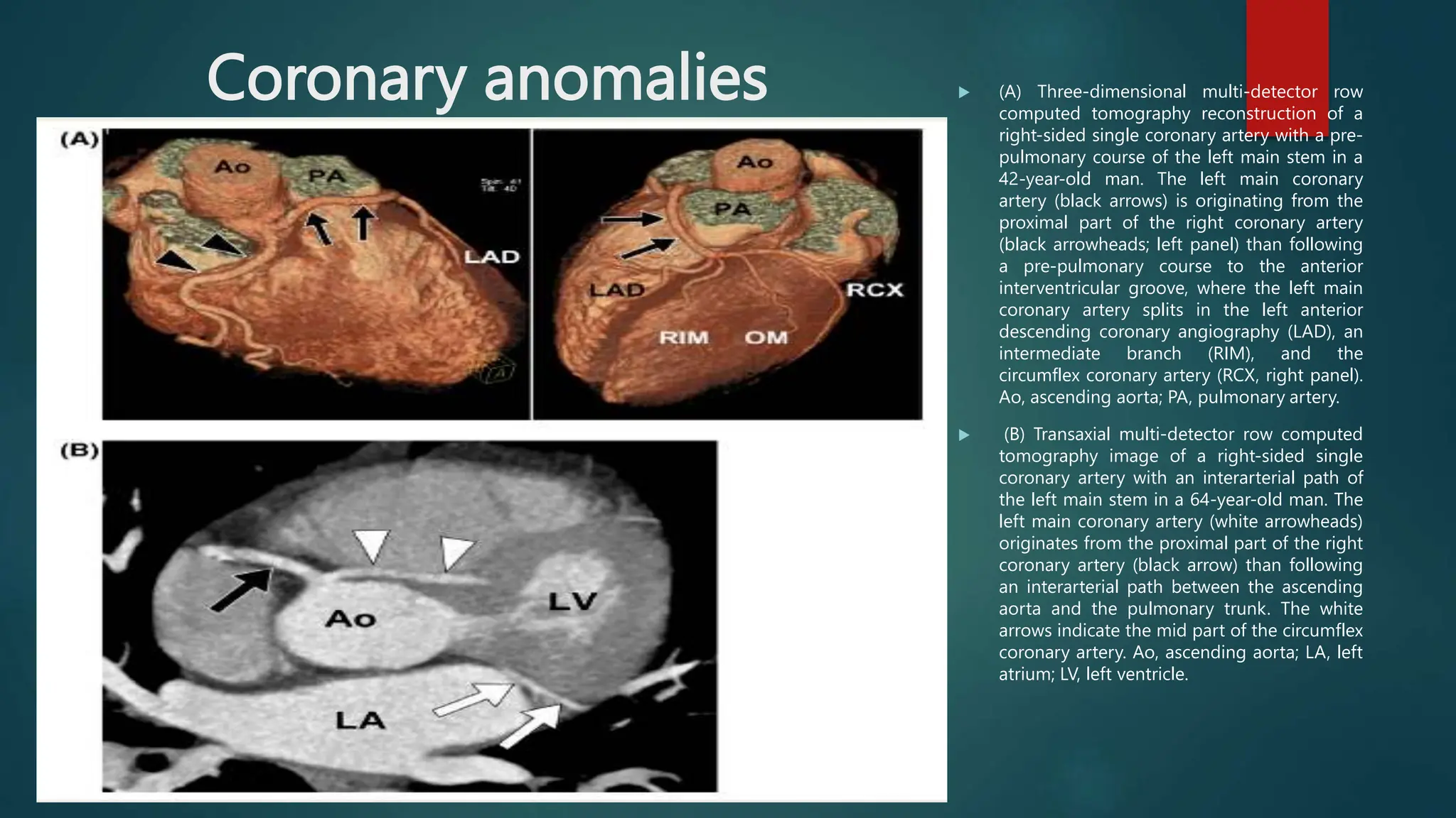 CT angiography.pptx