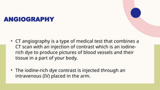 CT ANGIOGRAPHY.pptxGFGDNHDFDHDDDNHDNRRRNDHTY | PPT