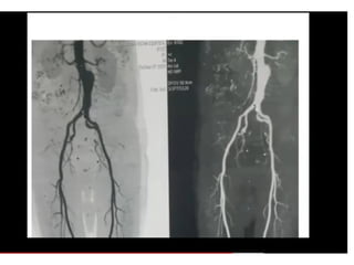 CT Angiography.pdf