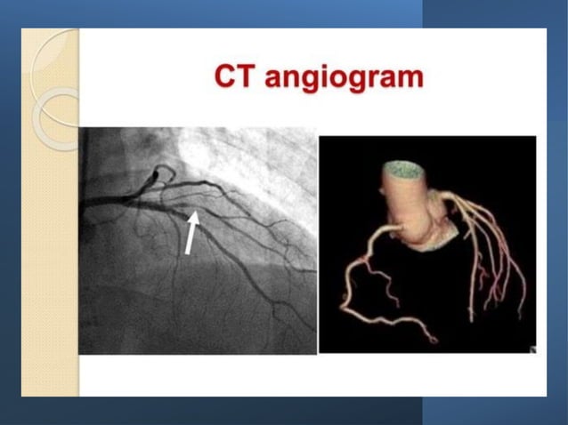 CT Angiography.pdf