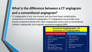 ct angiography and pre and post scans by WAQAS MAHMOOD RIT 6TH SEMESTER ...