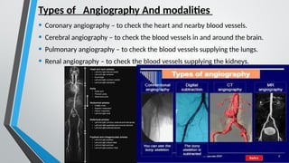 ct angiography and pre and post scans by WAQAS MAHMOOD RIT 6TH SEMESTER ...