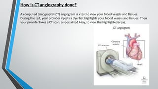 ct angiography and pre and post scans by WAQAS MAHMOOD RIT 6TH SEMESTER ...
