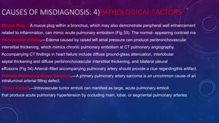 CT AnGIOGRAPHY of pulmonary embolism.pptx