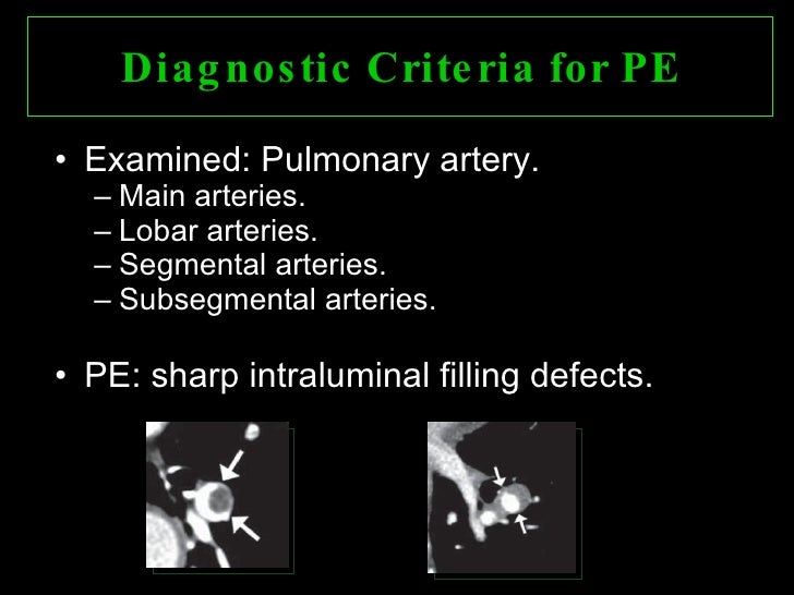 CTA OF PULMONARY EMBOLISM