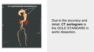 CT Aortogram For Aortic Dissection | PPS