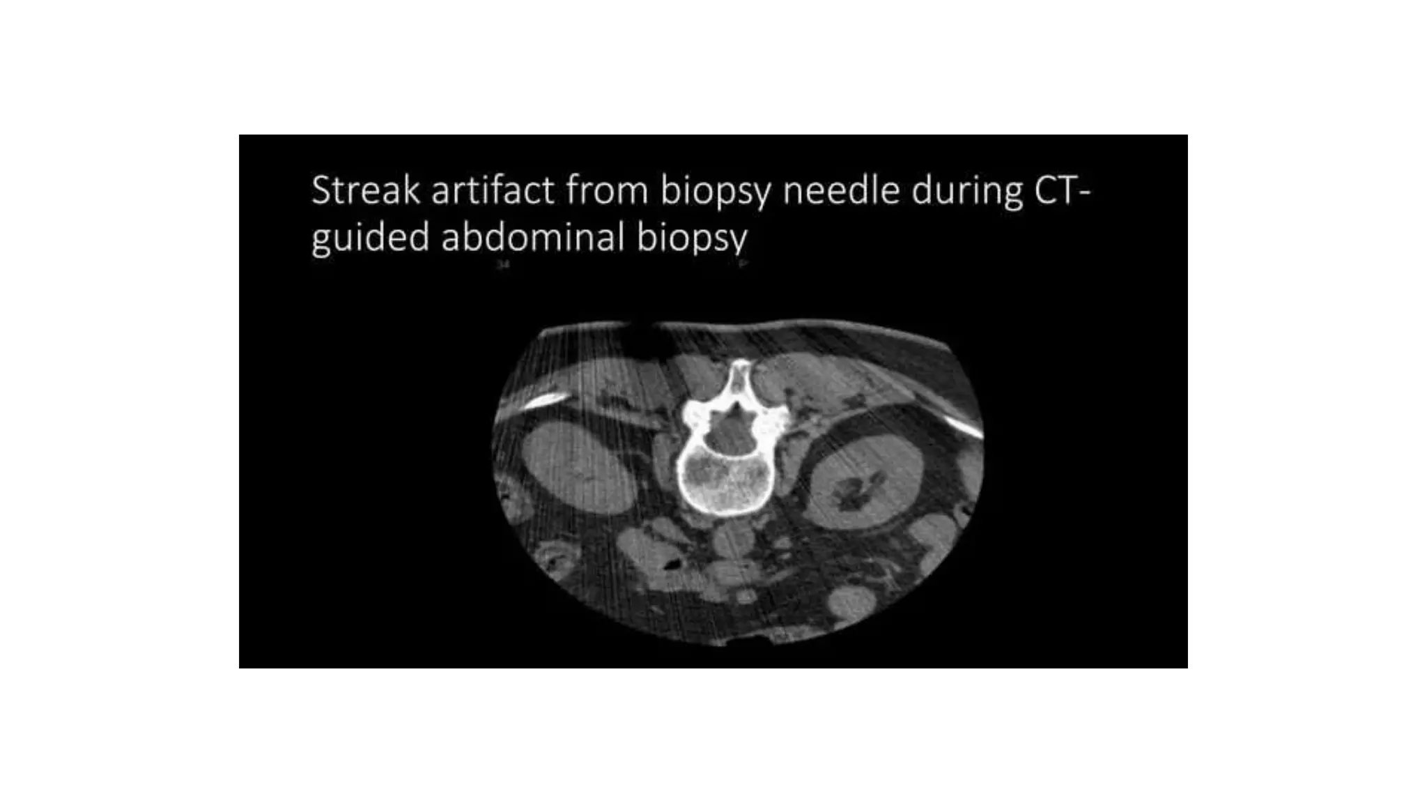 CT ARTIFACTS.pptx