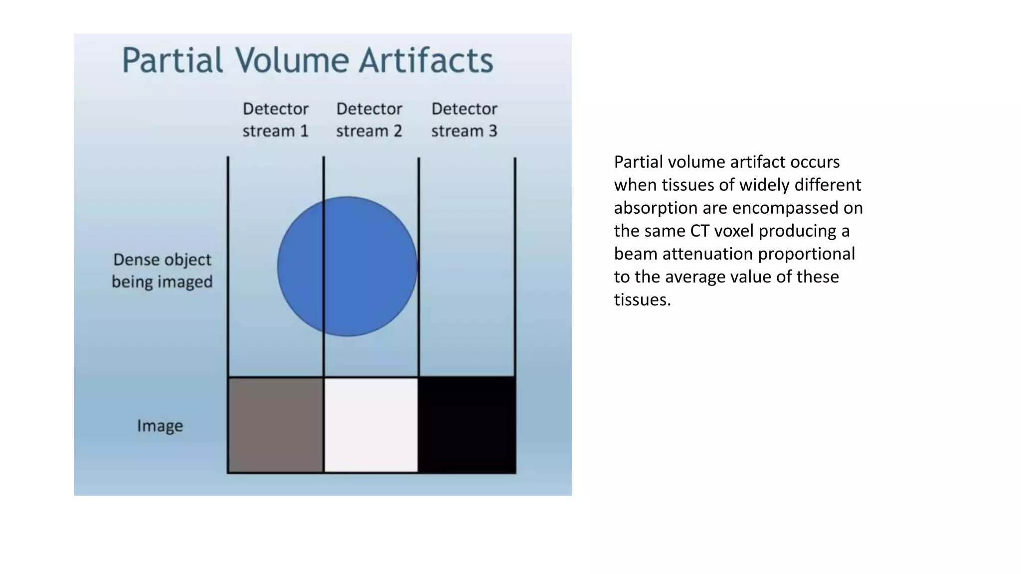 Ct Artifactspptx 
