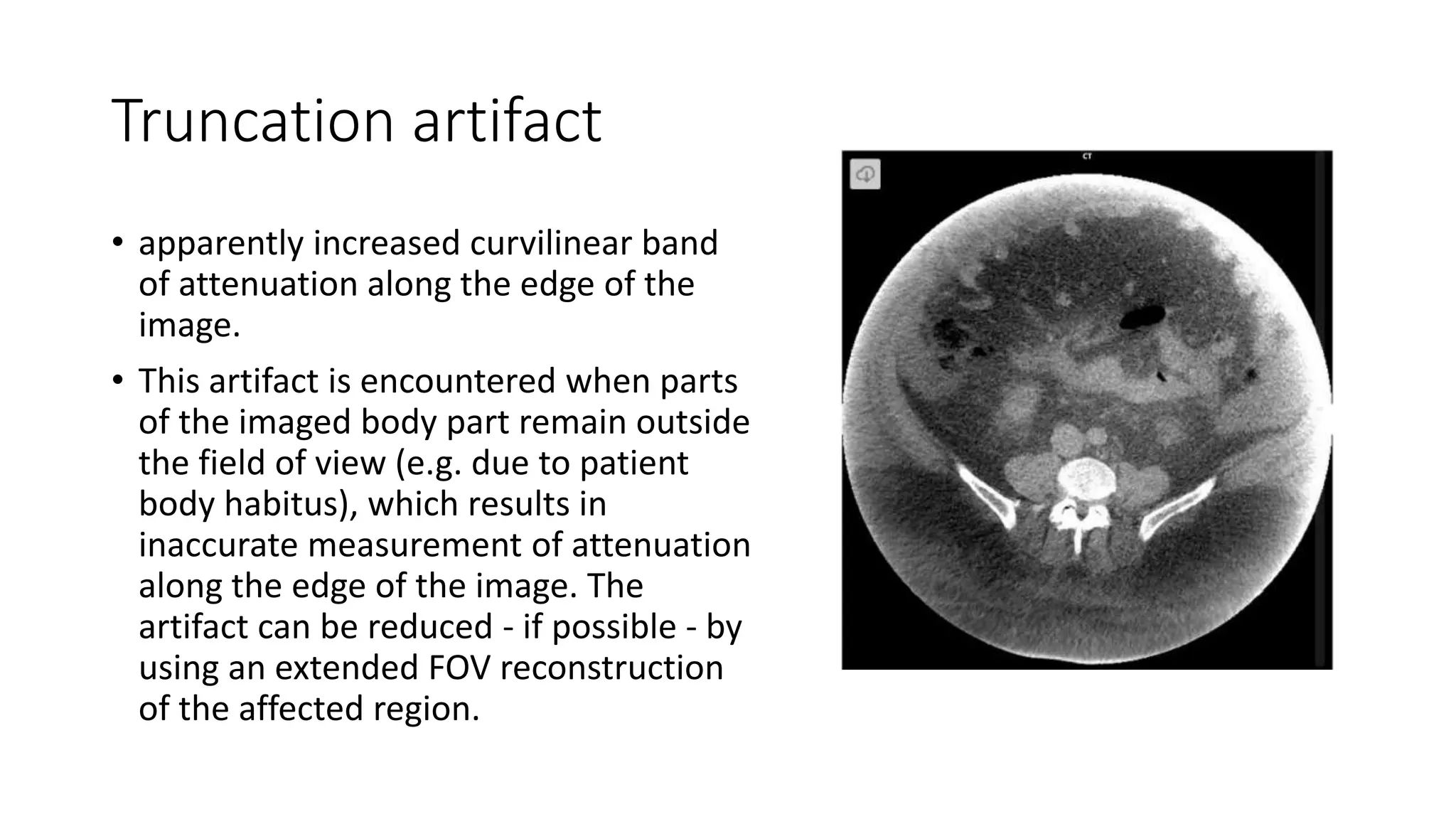 Ct Artifactspptx 