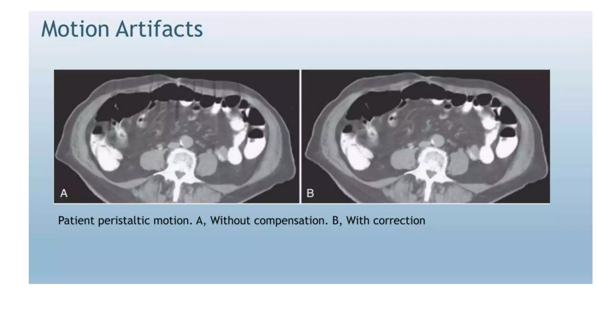 Ct Artifactspptx 