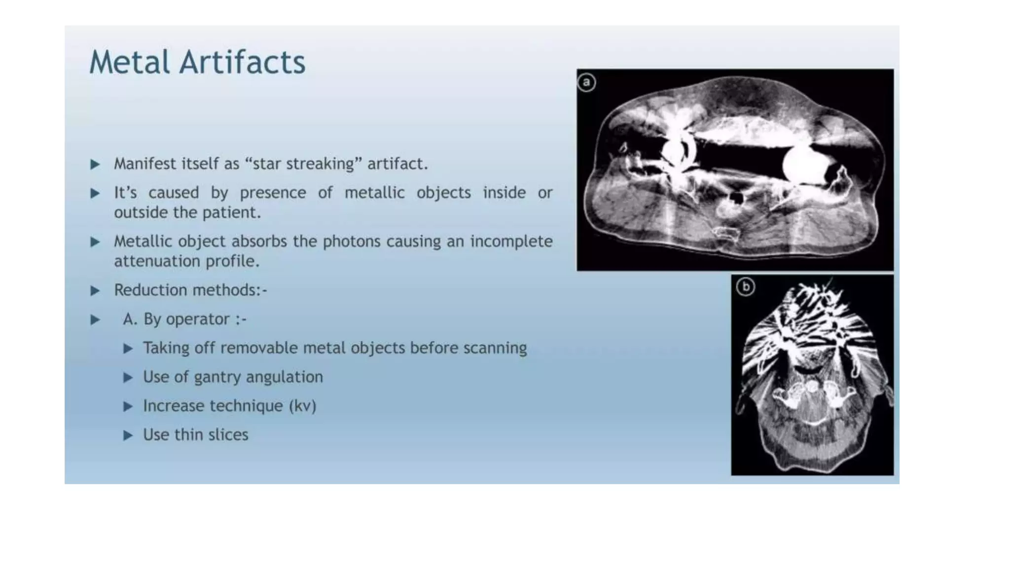 Ct Artifactspptx