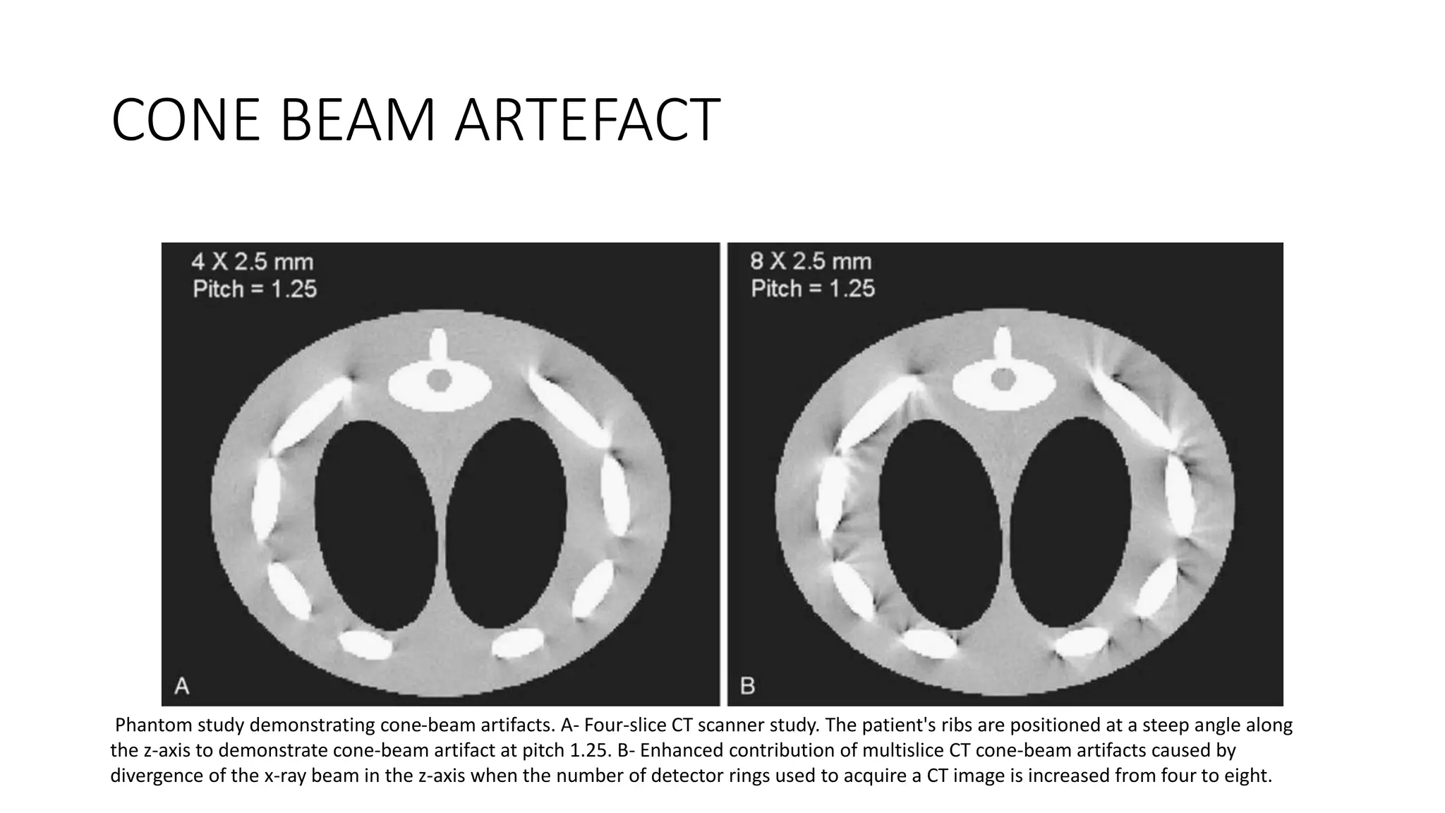 CT ARTIFACTS.pptx