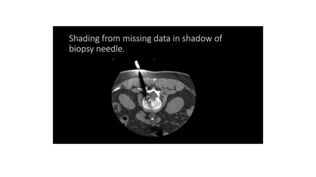 Ct Artifacts Pptx