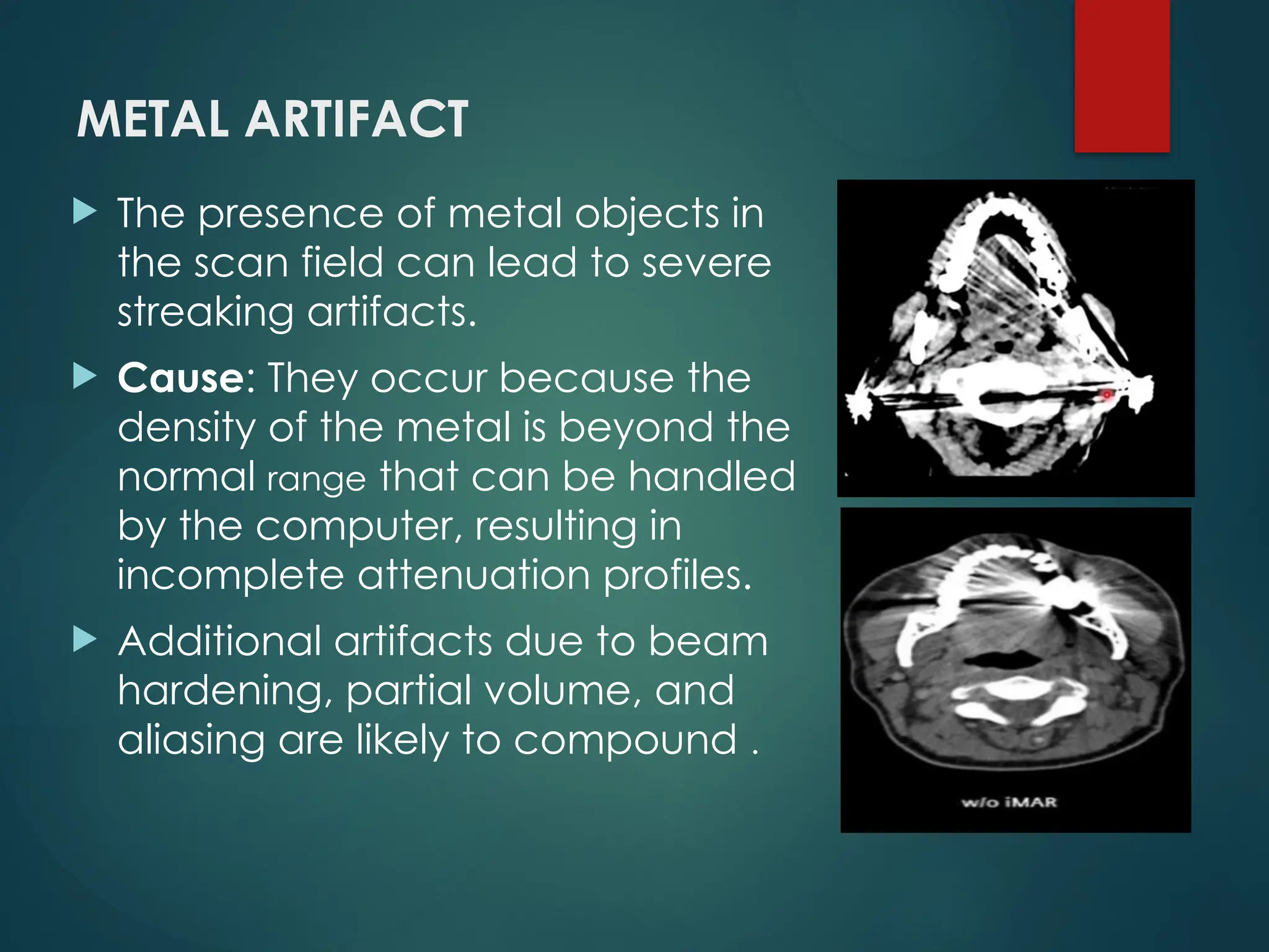 ct artefacts final part 1.pptx good ppt on ct artefacts | PPTX