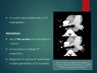ct artefacts final part 1.pptx good ppt on ct artefacts | PPTX