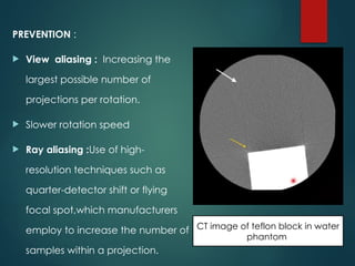 ct artefacts final part 1.pptx good ppt on ct artefacts | PPTX