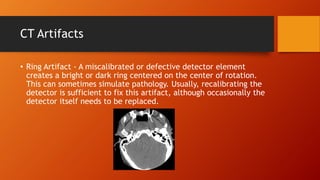 CT Artifacts | PPTX