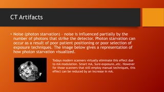 CT Artifacts | PPTX