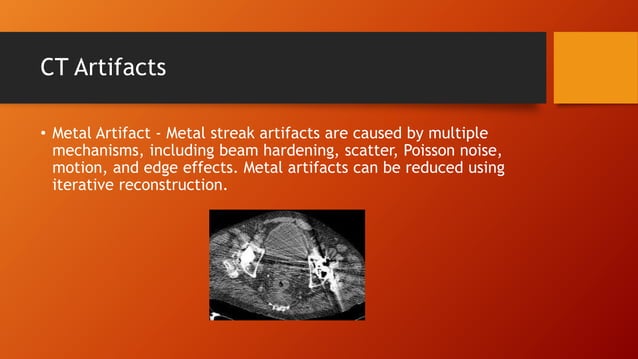 CT Artifacts | PPTX | Physics | Science