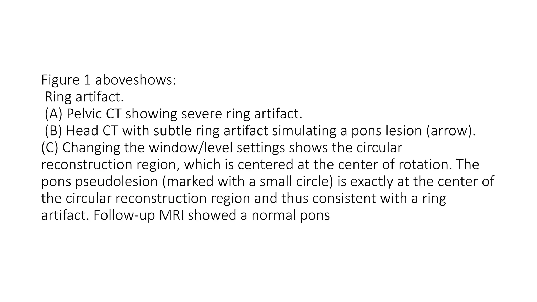 DIFFERENT TYPES OF RADIOGRAPHY CT_ARTIFACTS | PPTX