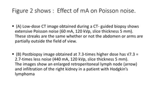 DIFFERENT TYPES OF RADIOGRAPHY CT_ARTIFACTS | PPTX