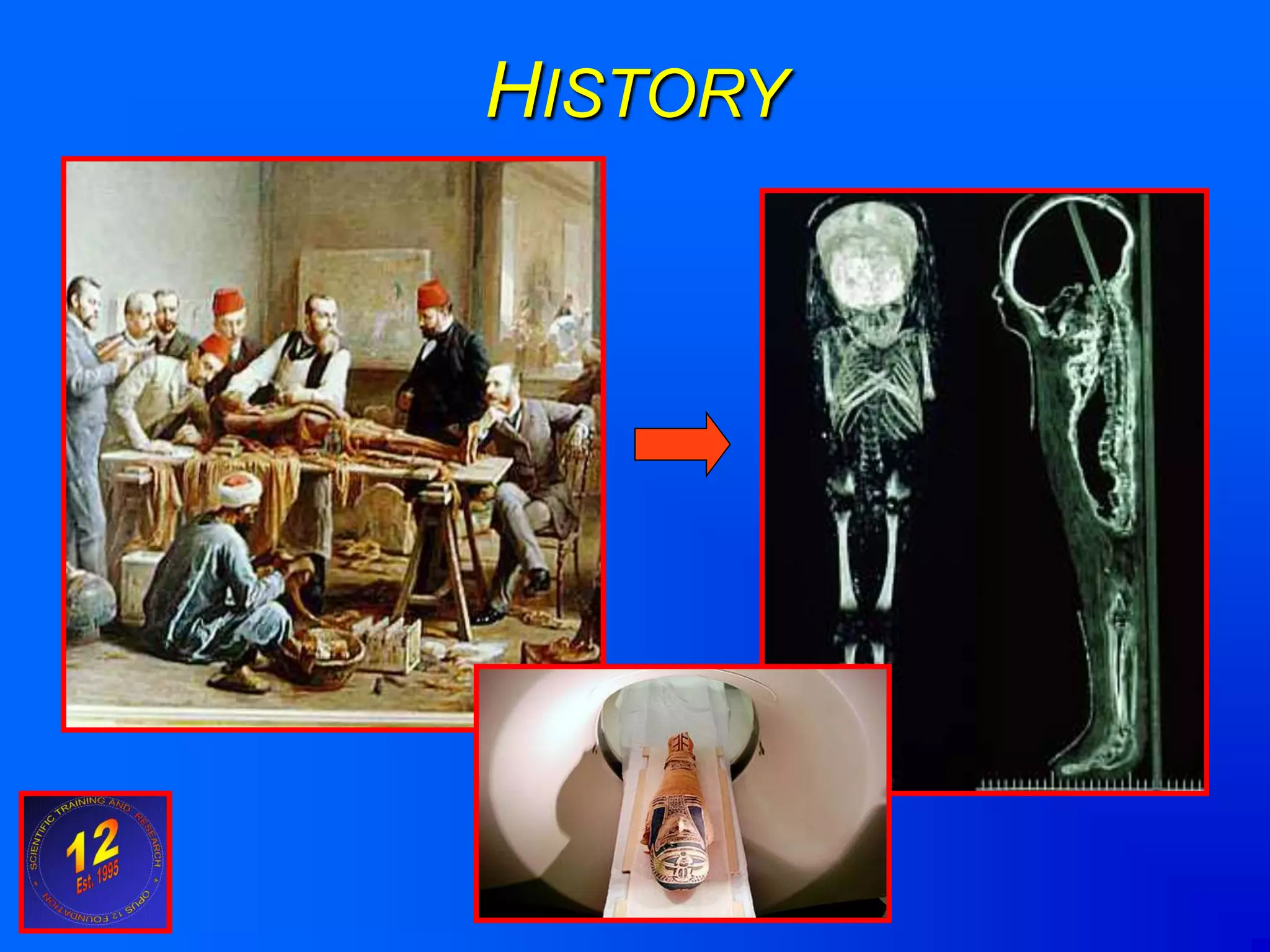 Ct autopsy 2008 - 02 - 22 stan | PPT