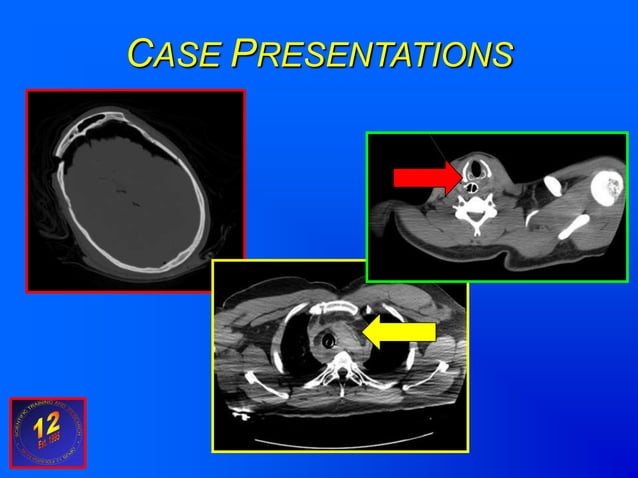 Ct autopsy 2008 - 02 - 22 stan | PPT
