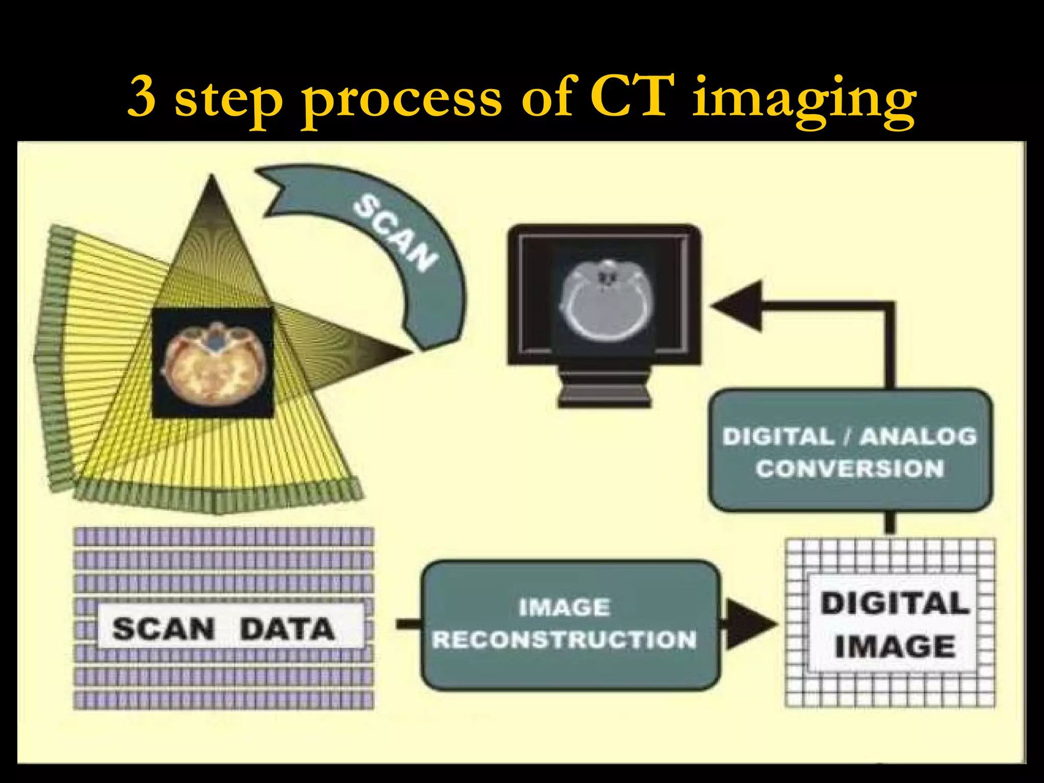 Ct Basics | PPT