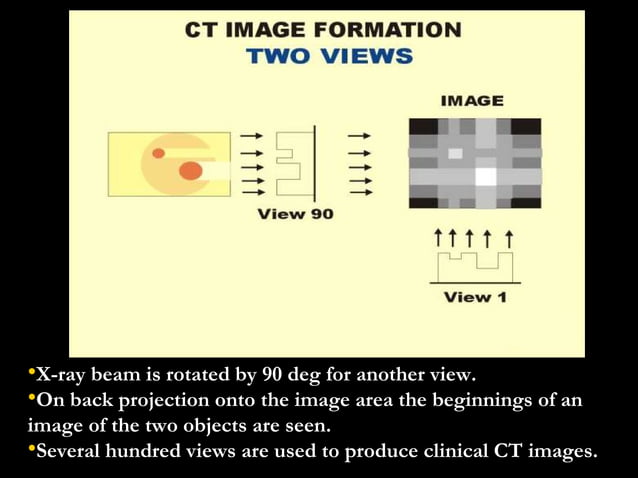 Ct Basics | PPT