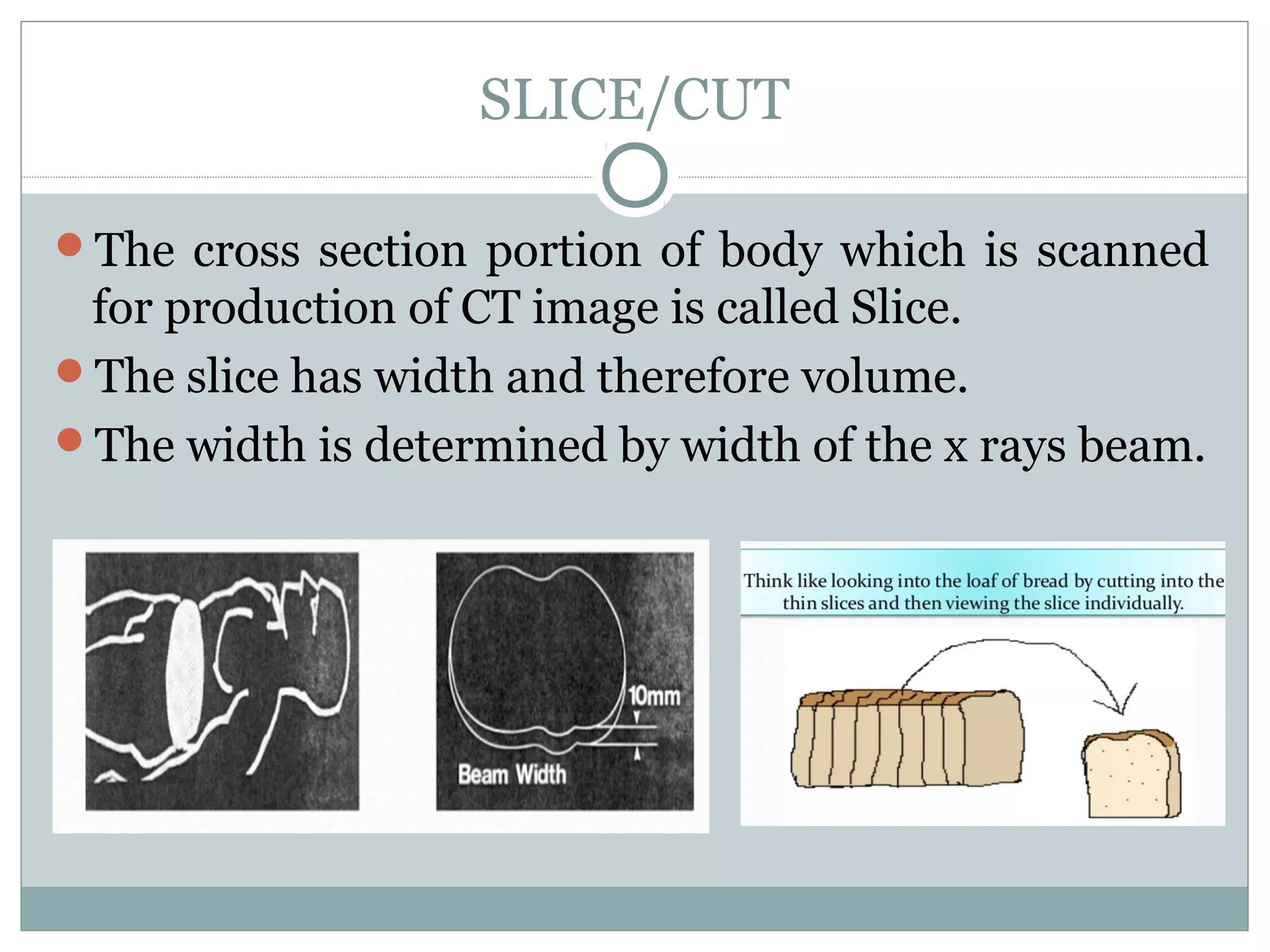 CT SCAN BASICS | PPT