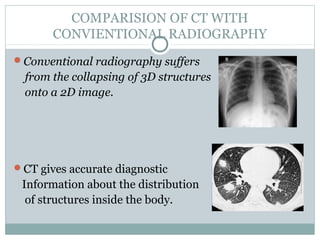 CT SCAN BASICS | PPT