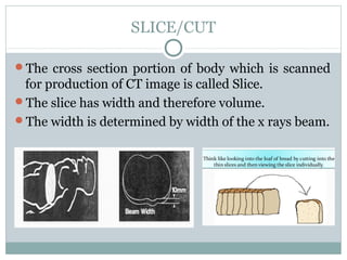 CT SCAN BASICS | PPT