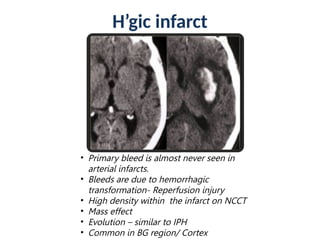 ct brai infarction ppt ct scanning of infarct | PPTX