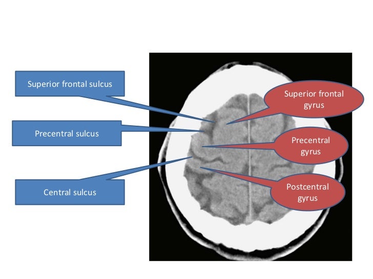 Ct brain by prof. Wael samir