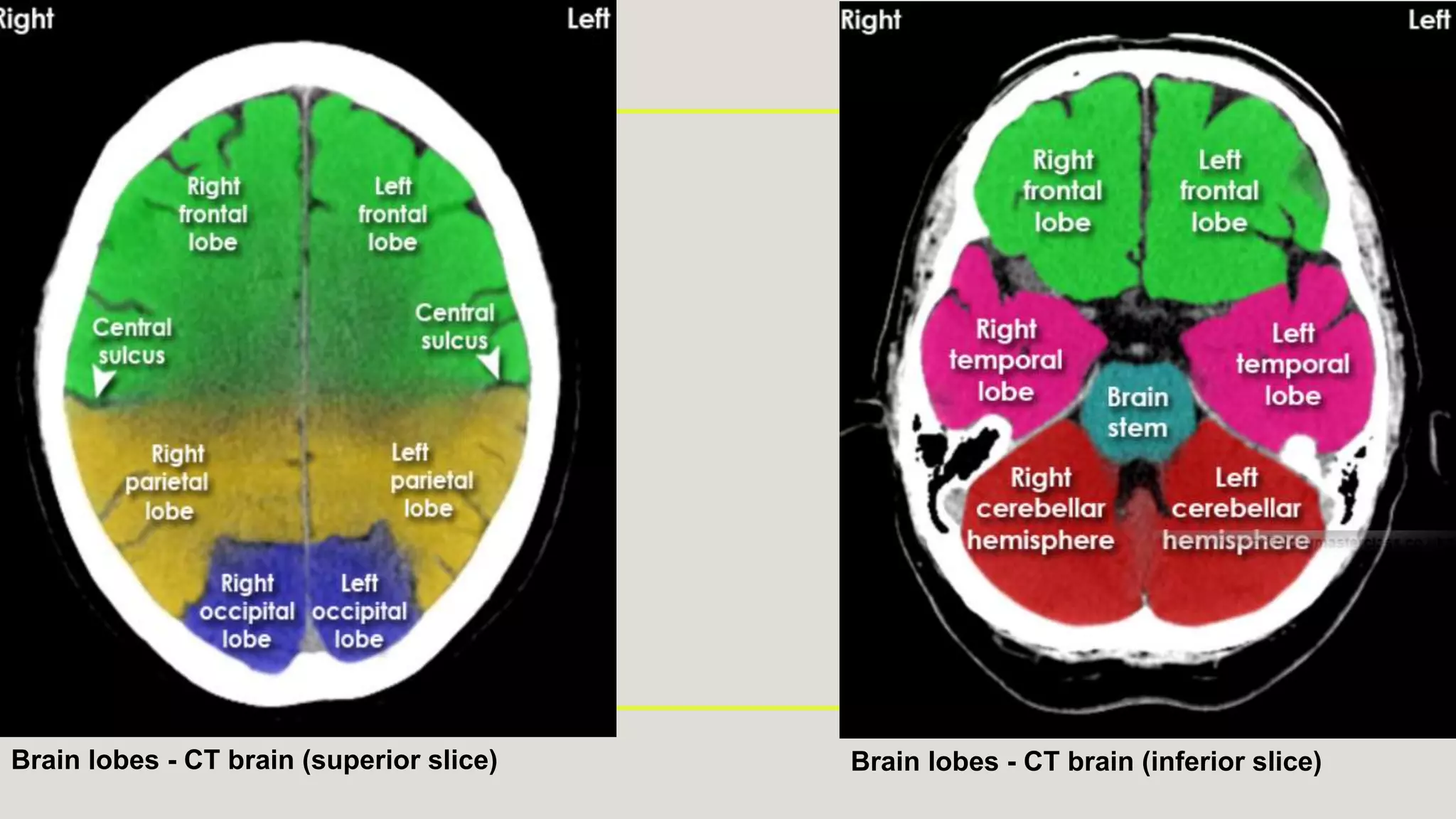 Radiological anatomy of brain.pptx