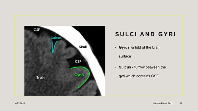 Radiological anatomy of brain.pptx | Brain and Nervous System Disorders | Diseases and Conditions