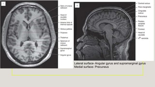 Radiological anatomy of brain.pptx