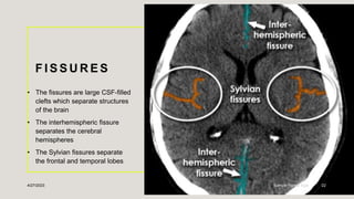 Radiological anatomy of brain.pptx