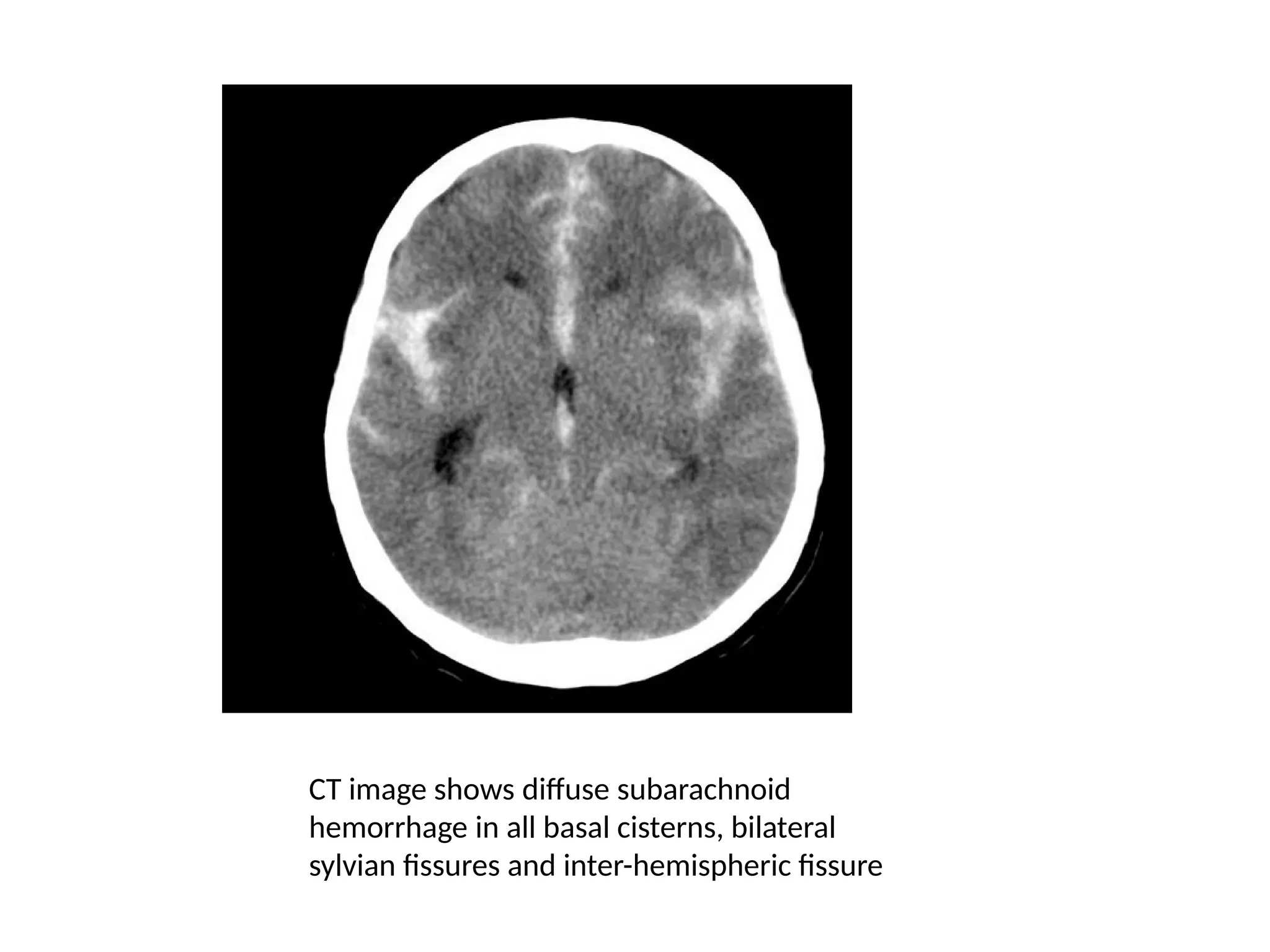 CT scan BRAIN pediatrics for residents.pptx