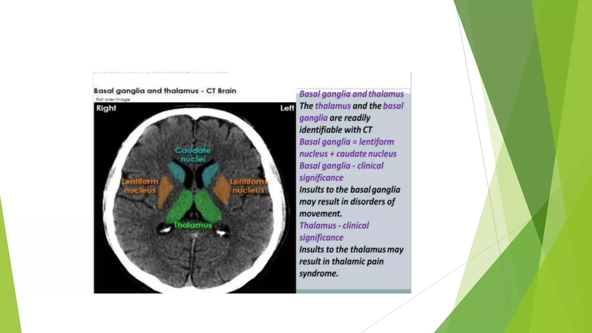 CT BRAIN-ANATOMY AND VASCULAR SUPPLY-FINAL PPT.pptx