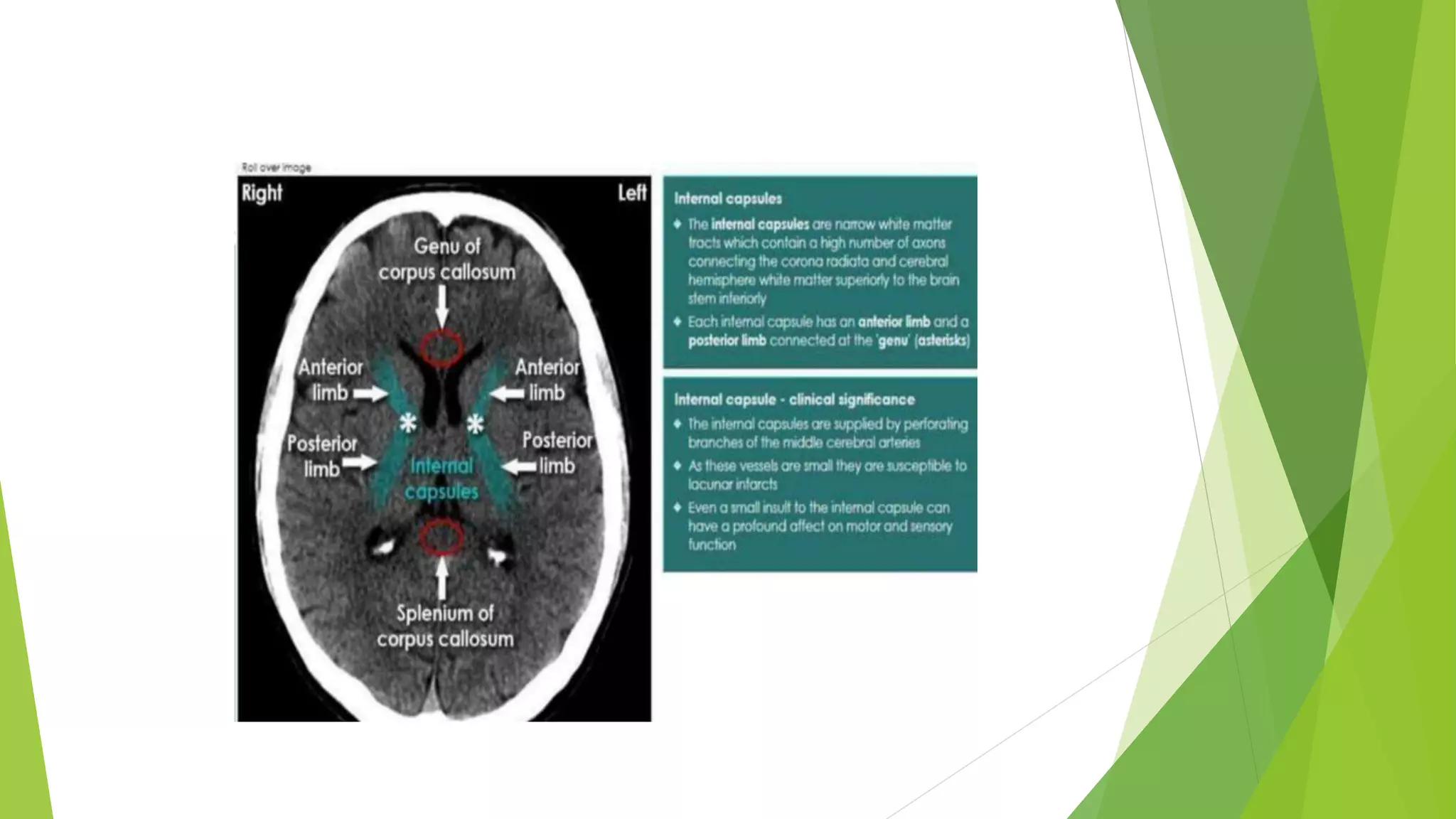 CT BRAIN-ANATOMY AND VASCULAR SUPPLY-FINAL PPT.pptx