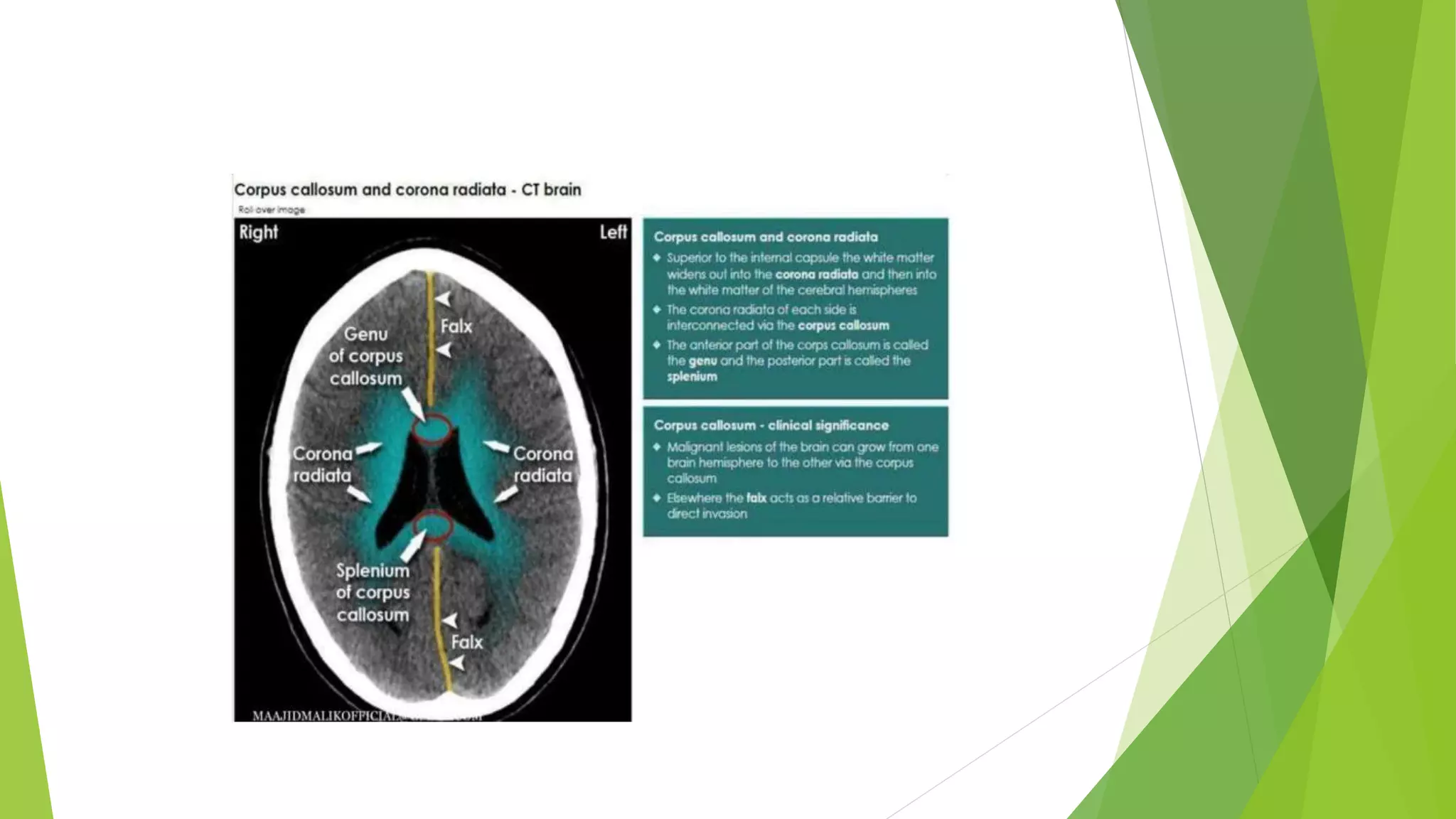 CT BRAIN-ANATOMY AND VASCULAR SUPPLY-FINAL PPT.pptx