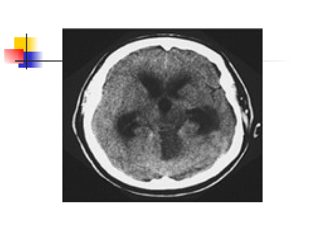 Ct brain basics and anatomy | PPT | Medical Tests | Medical Health