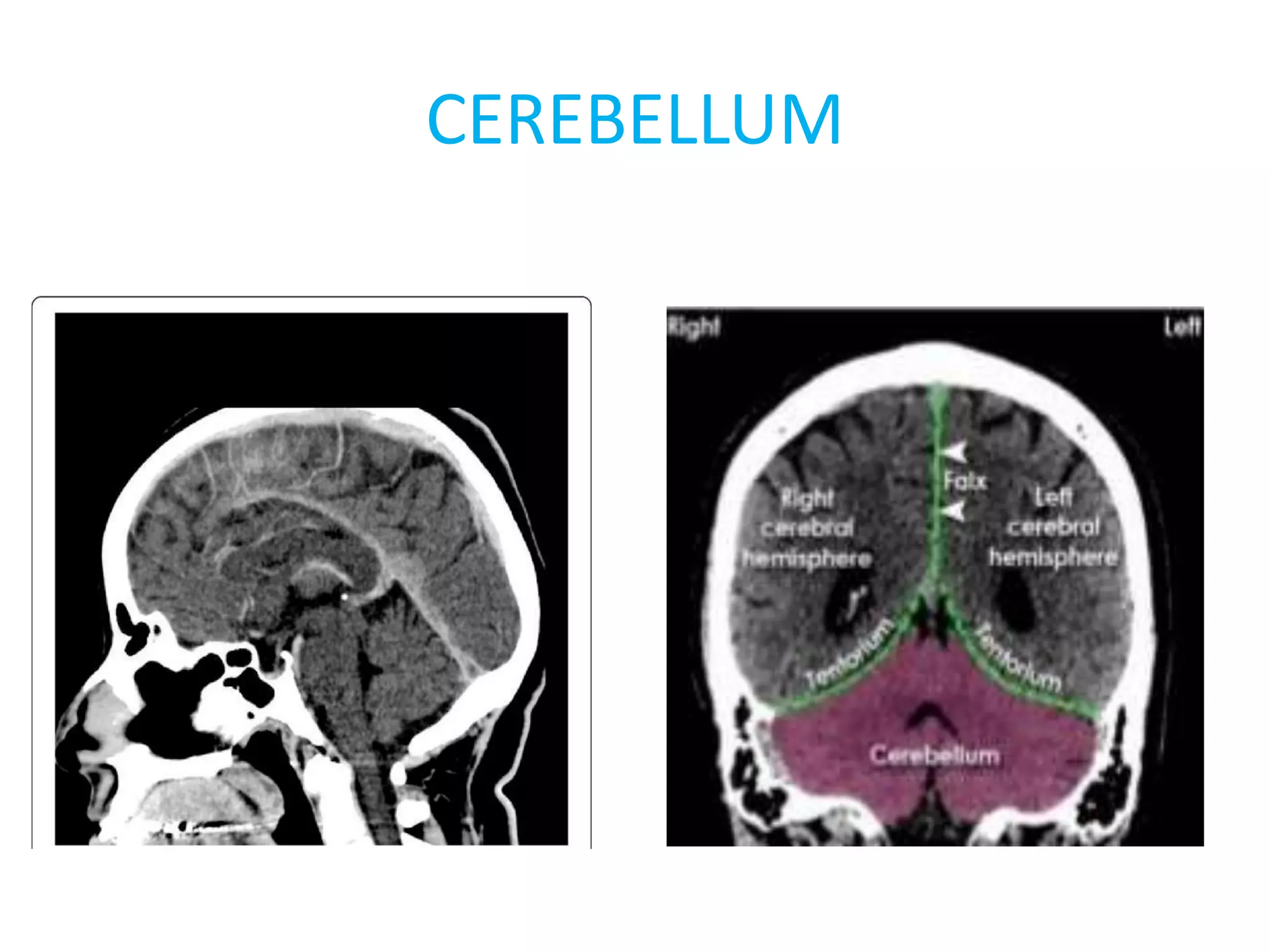 CT BRAIN ANATOMY.pptx
