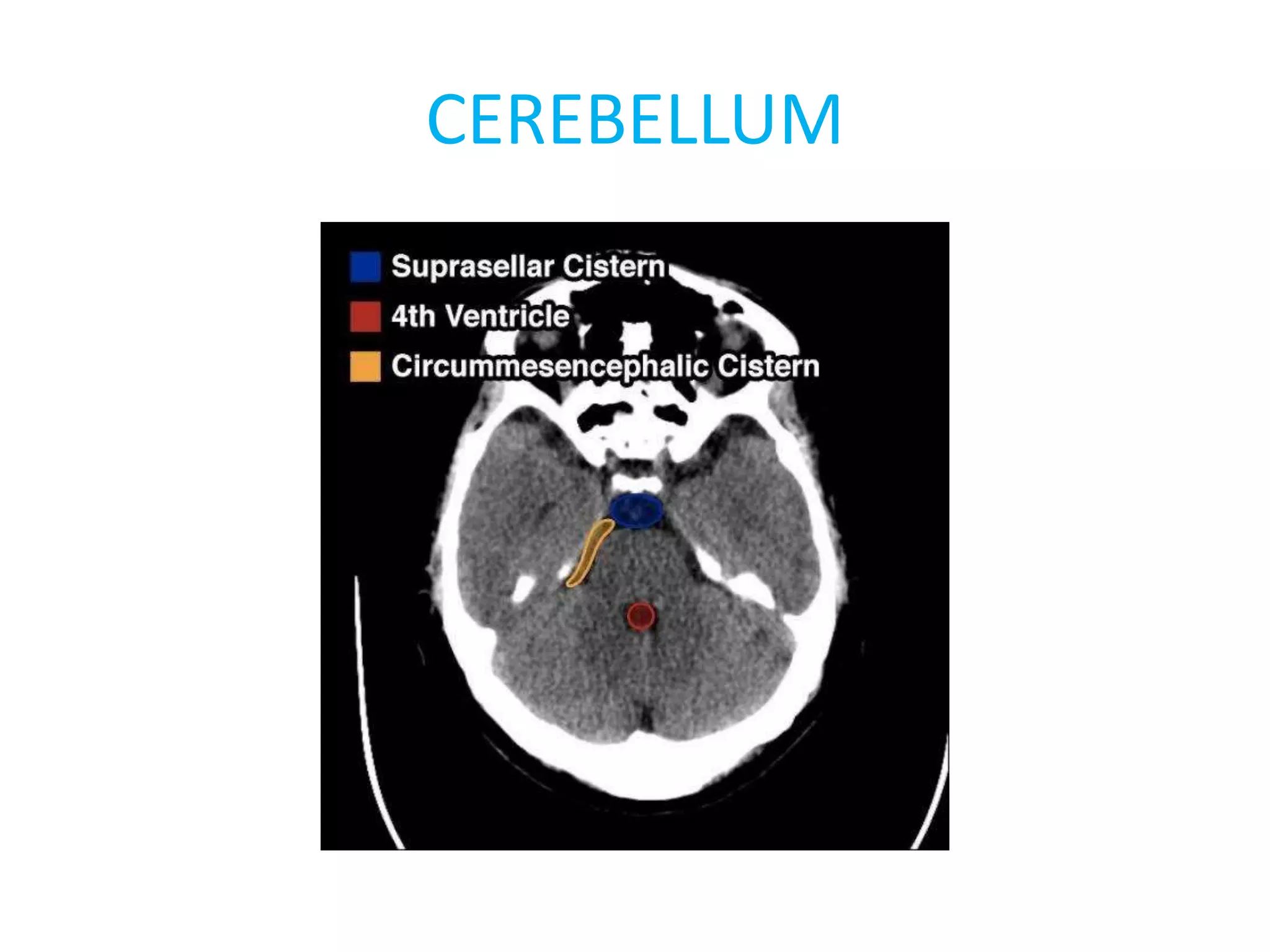 CT BRAIN ANATOMY.pptx