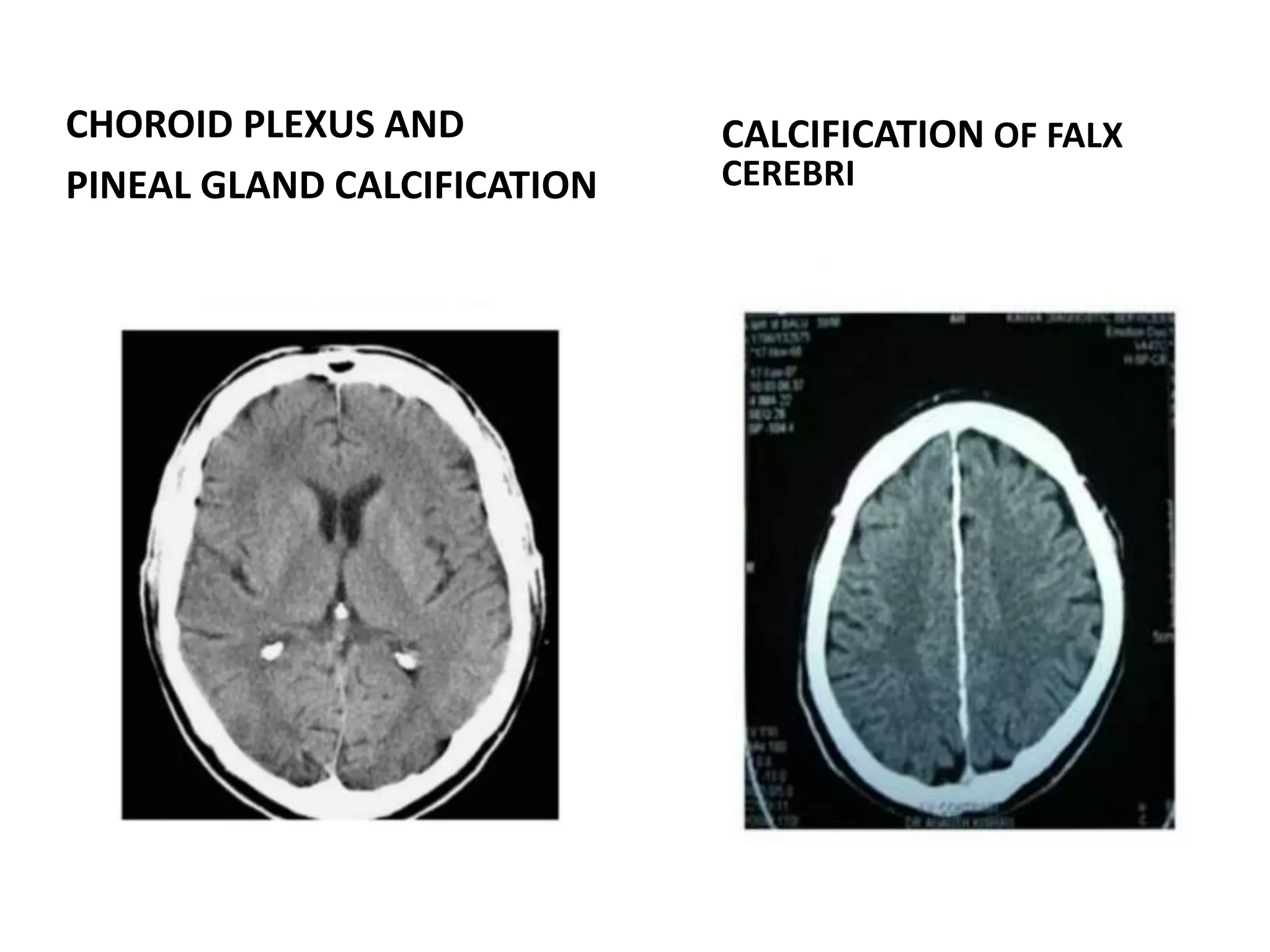 CT BRAIN ANATOMY.pptx