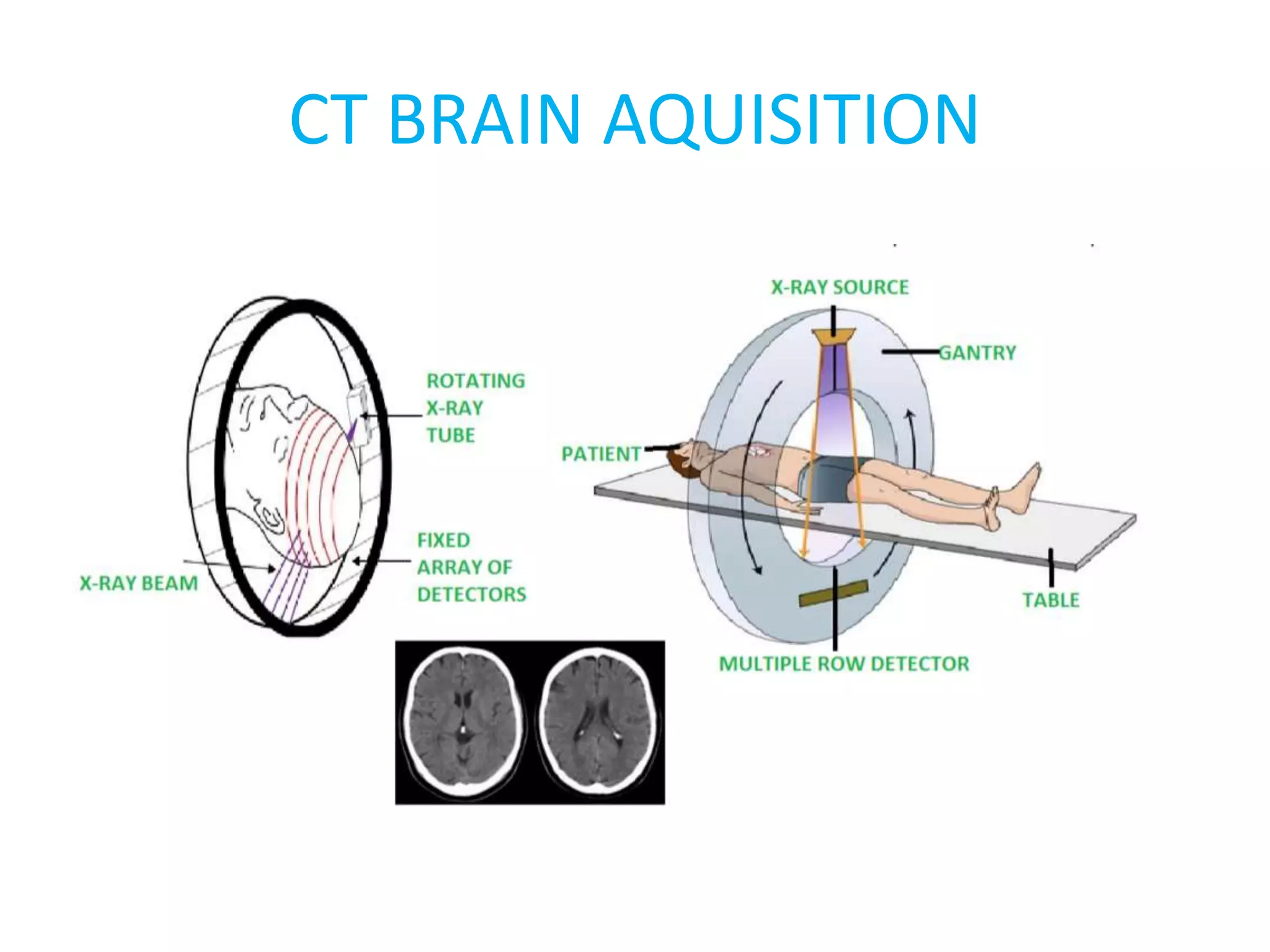 CT BRAIN ANATOMY.pptx