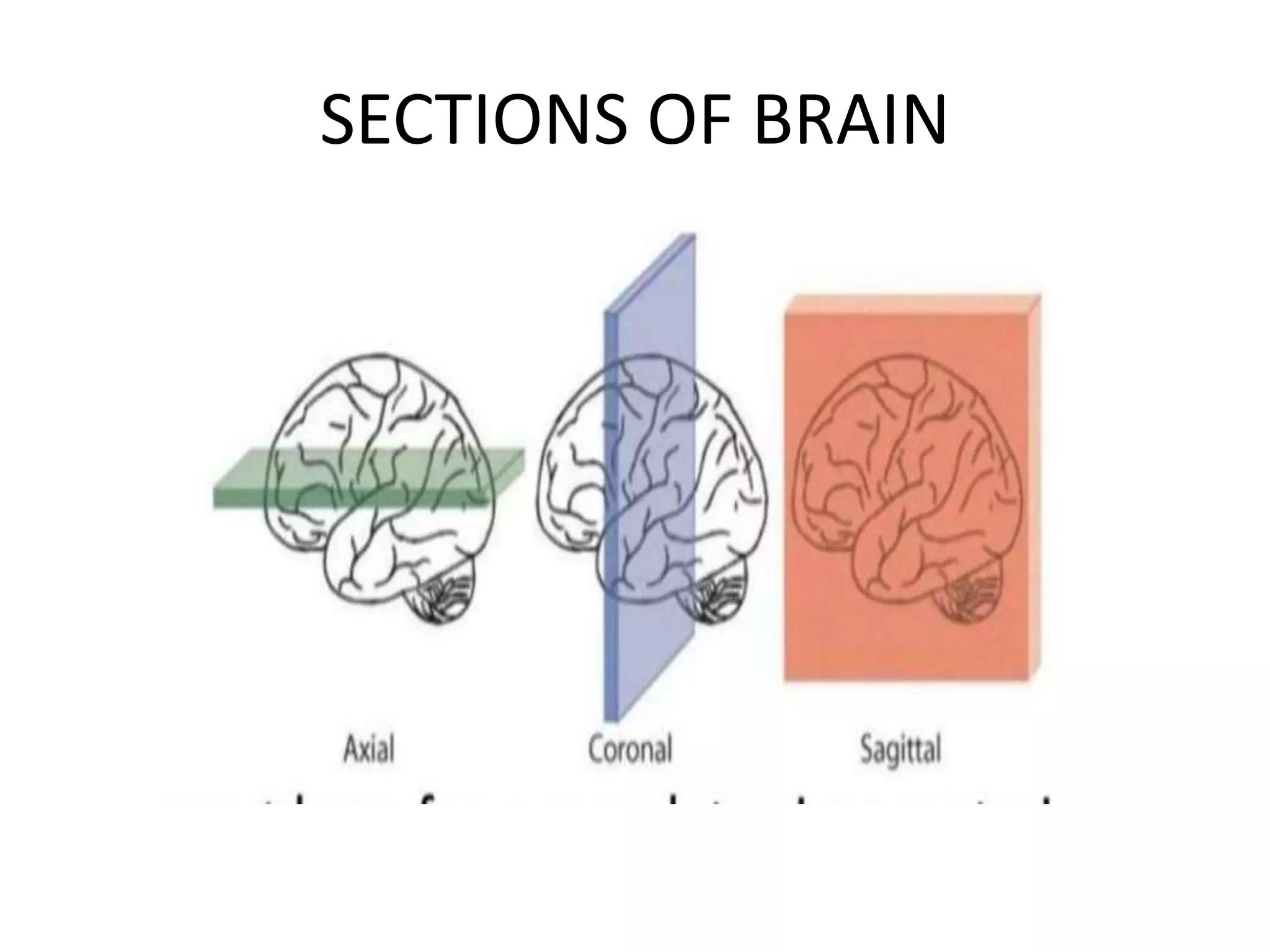 CT BRAIN ANATOMY.pptx