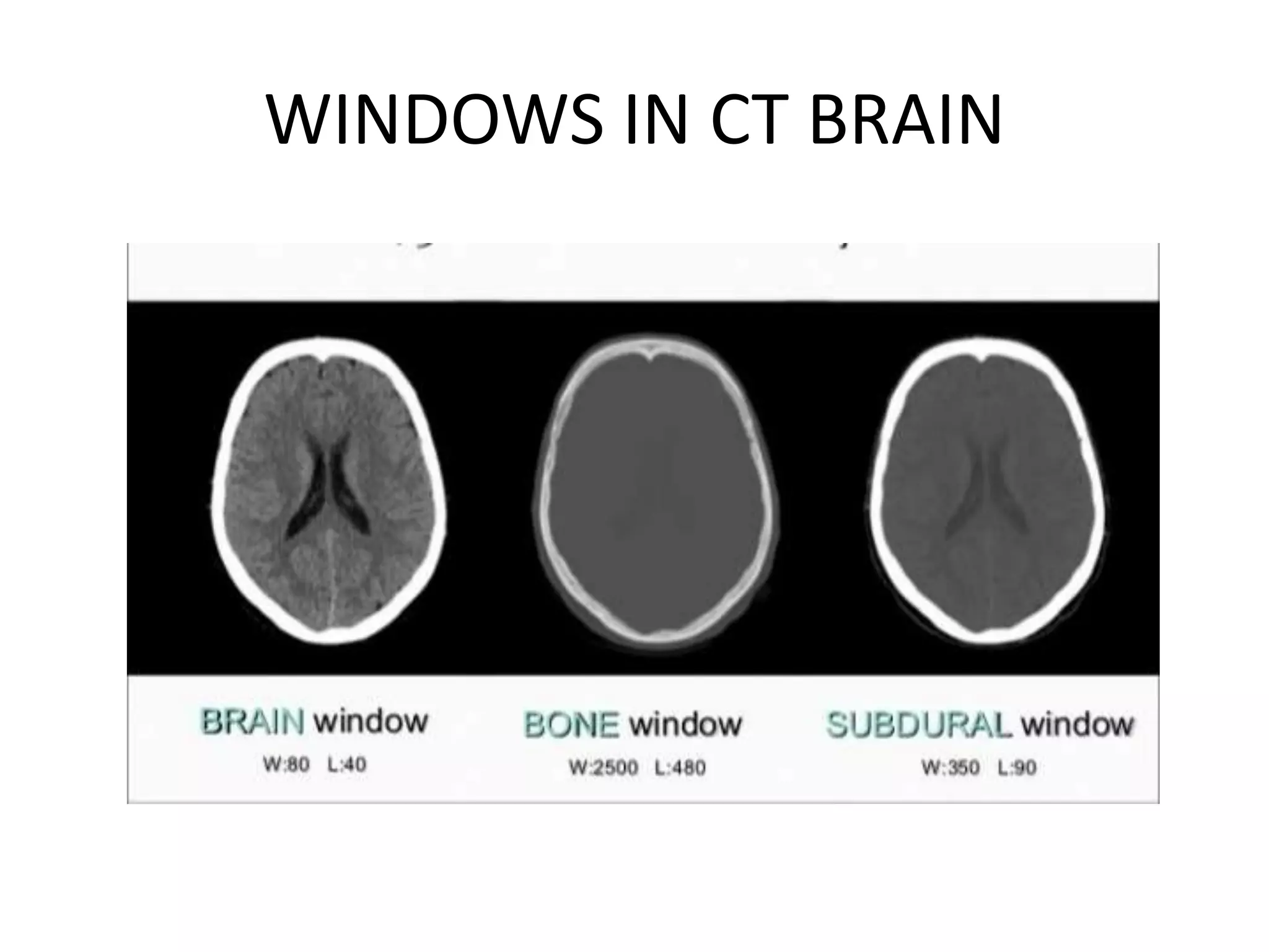 CT BRAIN ANATOMY.pptx