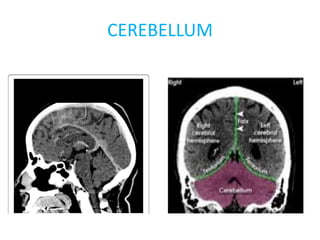 CT BRAIN ANATOMY.pptx